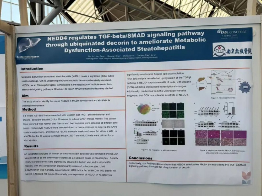 EASL 2025丨李婕教授团队：NEDD4通过泛素化修饰DCN调控TGF-β/SMAD信号通路改善MASH
